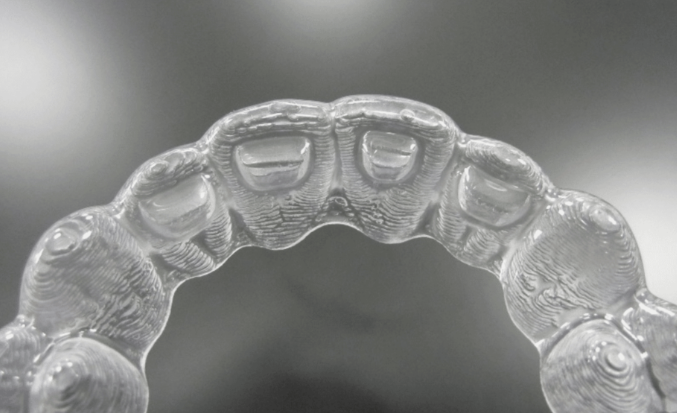 Fabrication 3D de modèles bite ramps - Académie dentaire